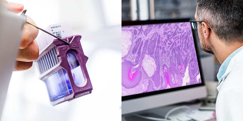 What Is Z-stacking Technique in Digital Pathology?